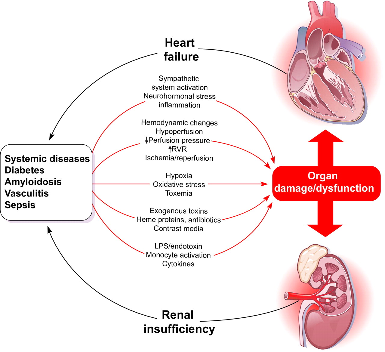 « Cardiorenal syndrome », qu’est-ce que cela? – Nephro.blog